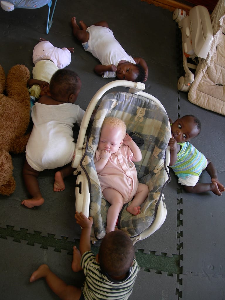 Malawi archbishop calls on government to stop ritual murder of albinos ...